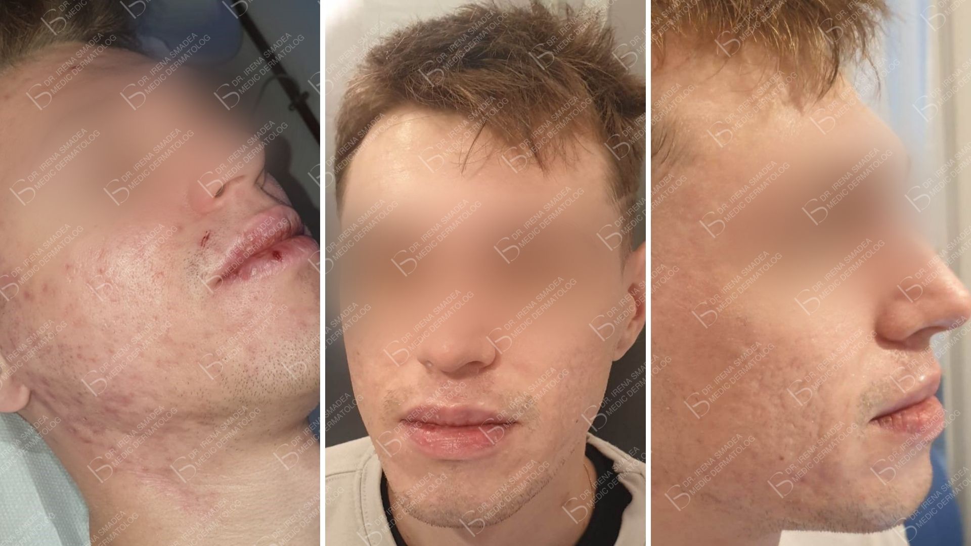 Portofoliu | Dr. Irena Smadea - Dermatolog Constanța